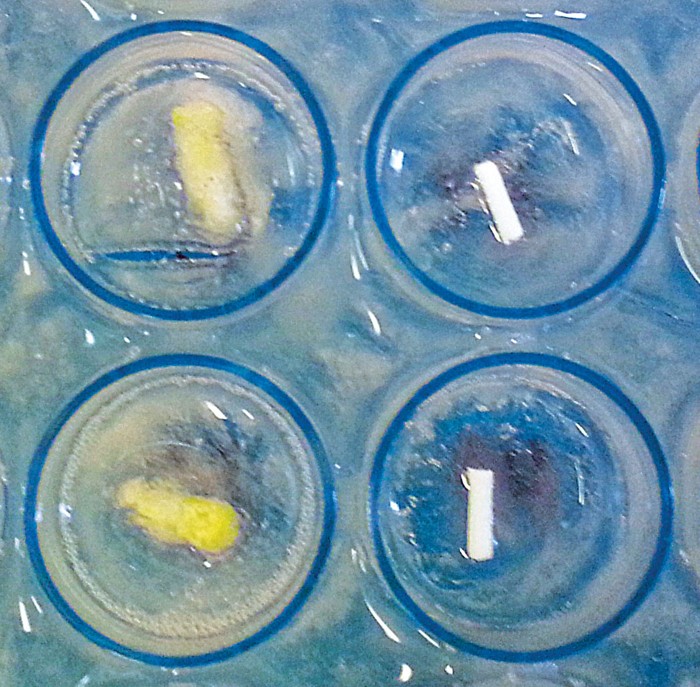 Biodegradable breast biopsy markers