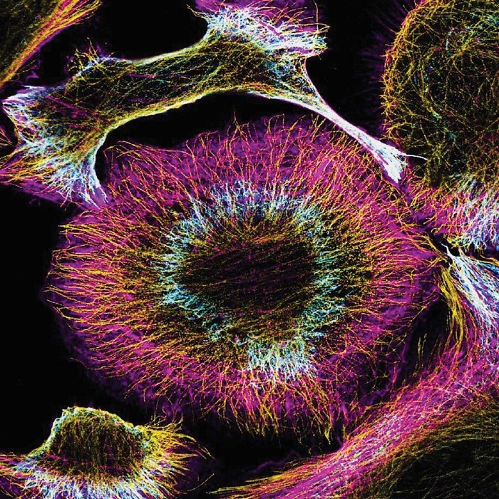 Chemistry in Pictures: The ‘bones’ inside your bones