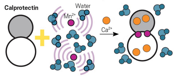 Protein tracks calcium levels in MRI