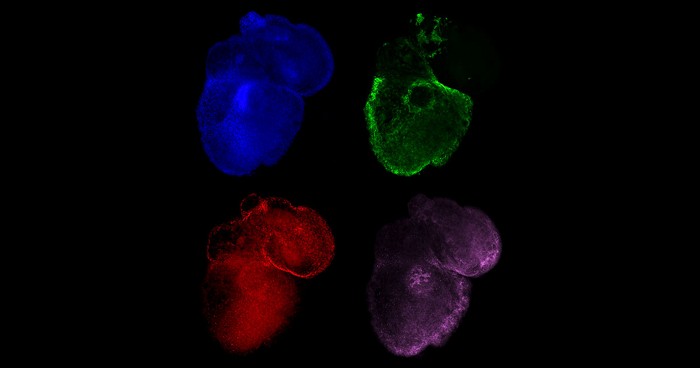 Chemistry in Pictures: Matters of the heart