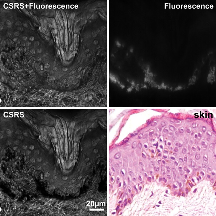 Human Skin Magnified