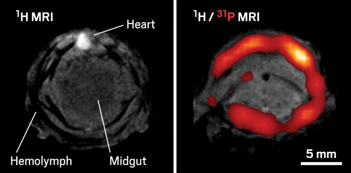 Biodegradable phosphoester polymers for greener MRI color