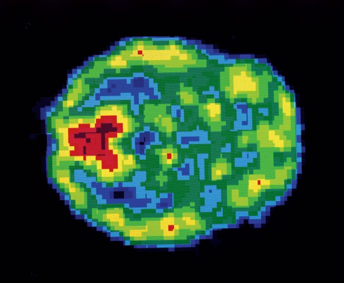 Kynexis sets sights on schizophrenia with $61 million