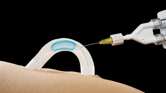 Contraceptive candidate acts by blocking sperm