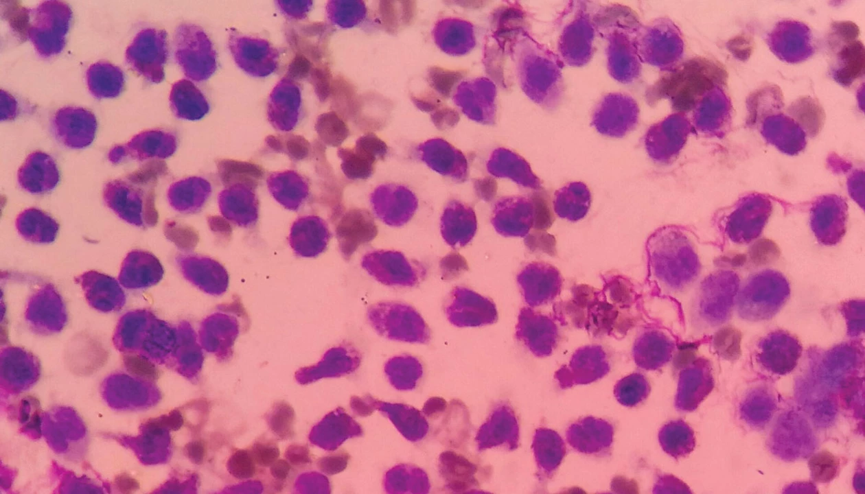 Ultrafast sepsis test pinpoints treatment in just 13 hours