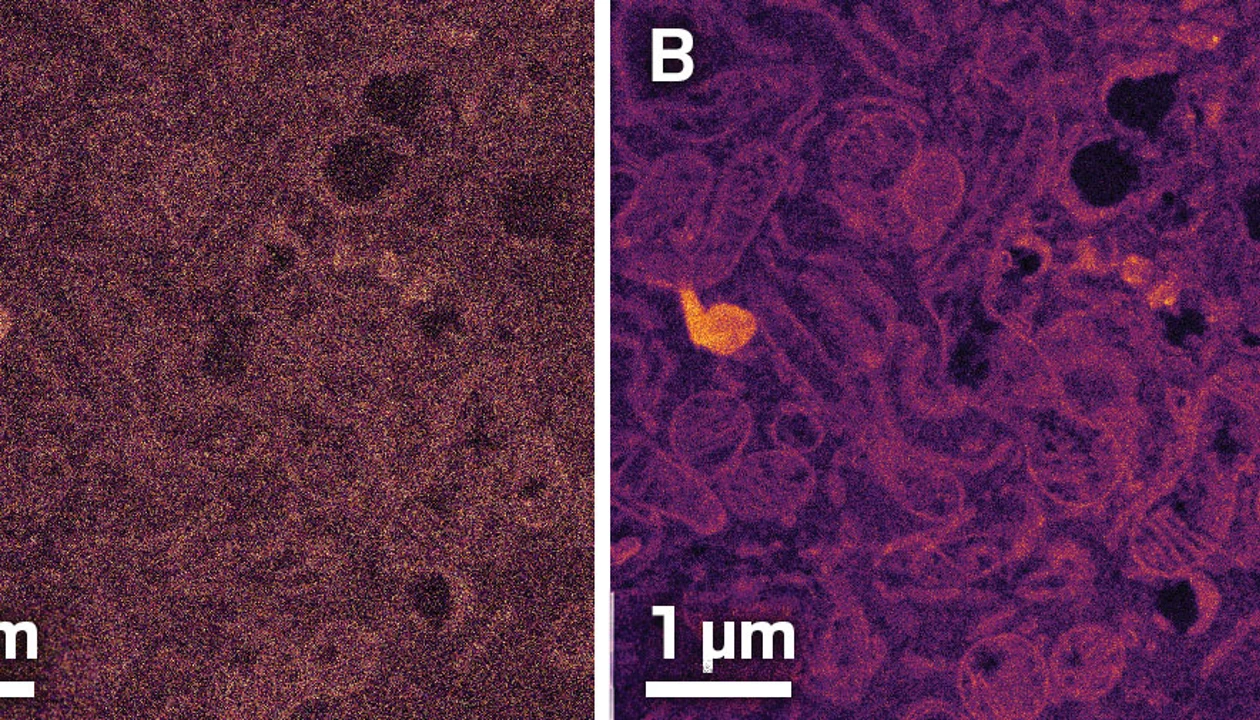 Clear electron microscope images, less damage