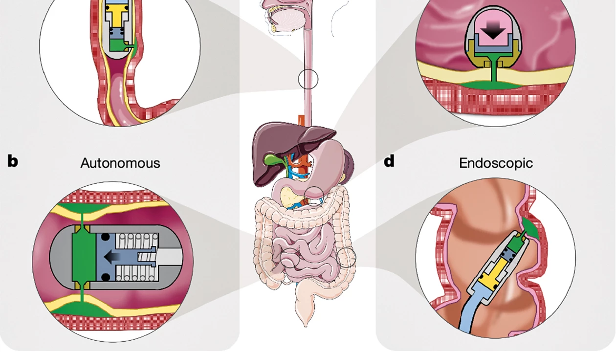 ‘Microjet’ devices could help replace needle injections