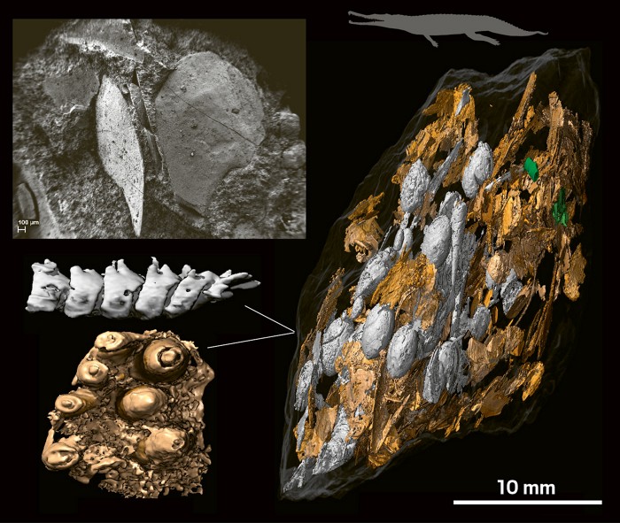 Vomiting Feces Diverticulitis Stool Pictures: Changes In Bowel