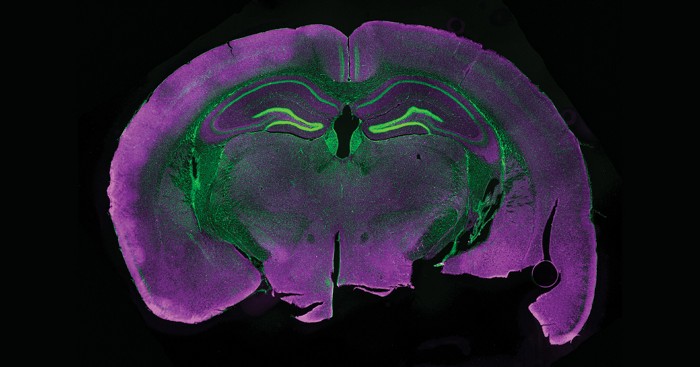 How “brainwashing” while sleeping clears waste away