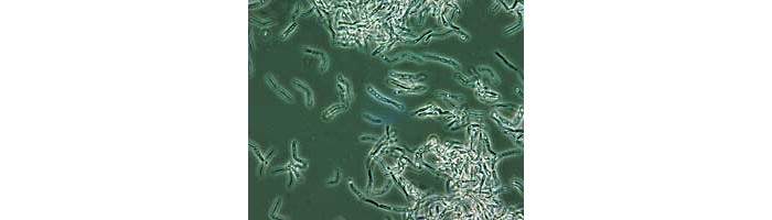 Finding-Anthrax-Field