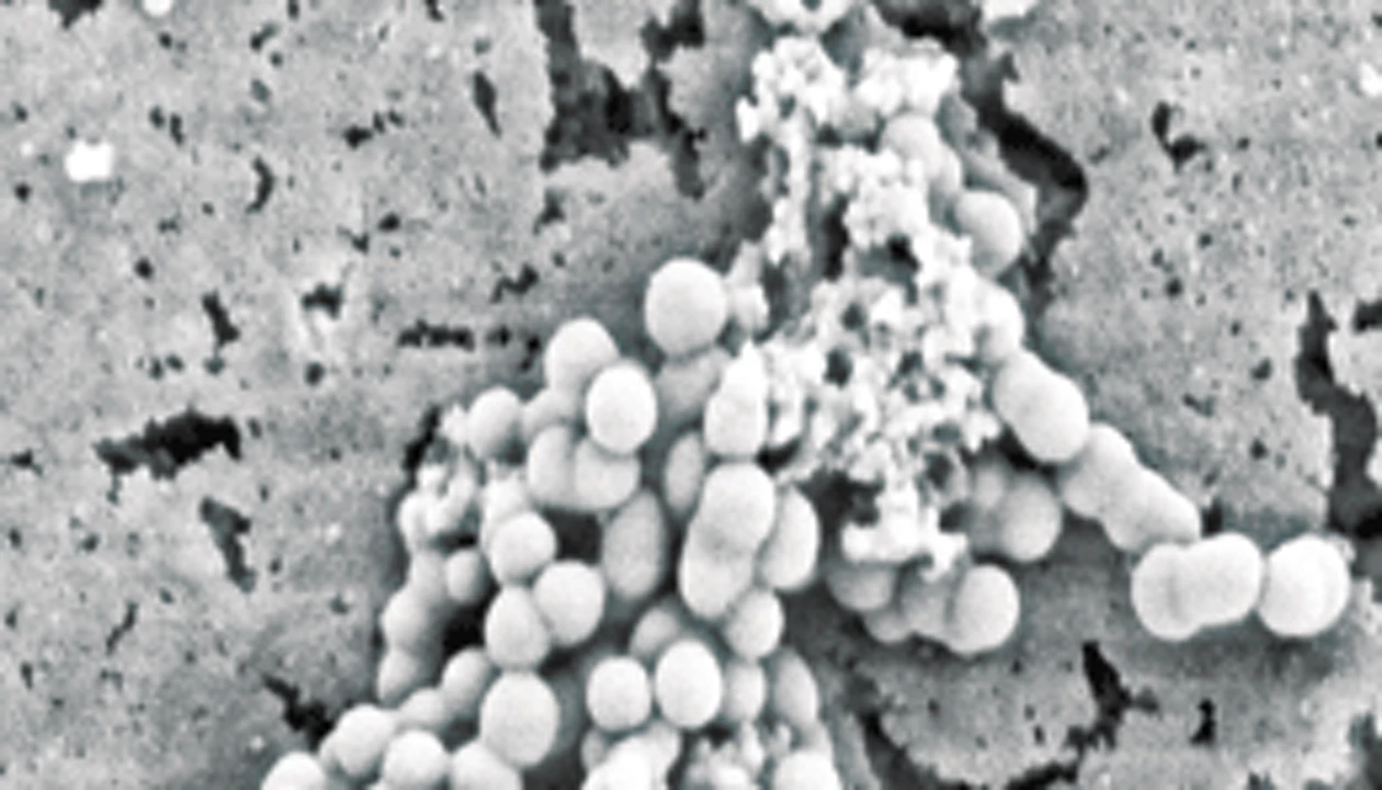 Silica-spider silk composites