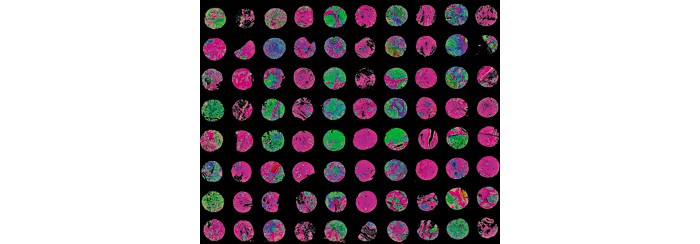 Moving-Bench-Bedside