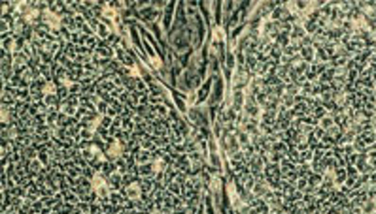 NIH Approves Additional Stem Cell Lines