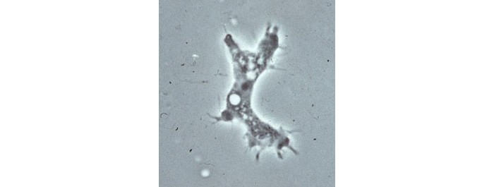 Amoebas-Found-Treated-Drinking-Water