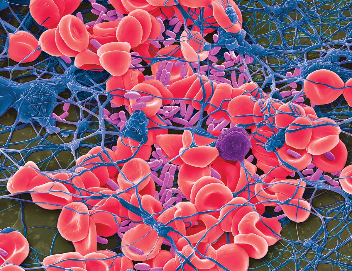 All-in-one test could fast-track care for people with possible sepsis