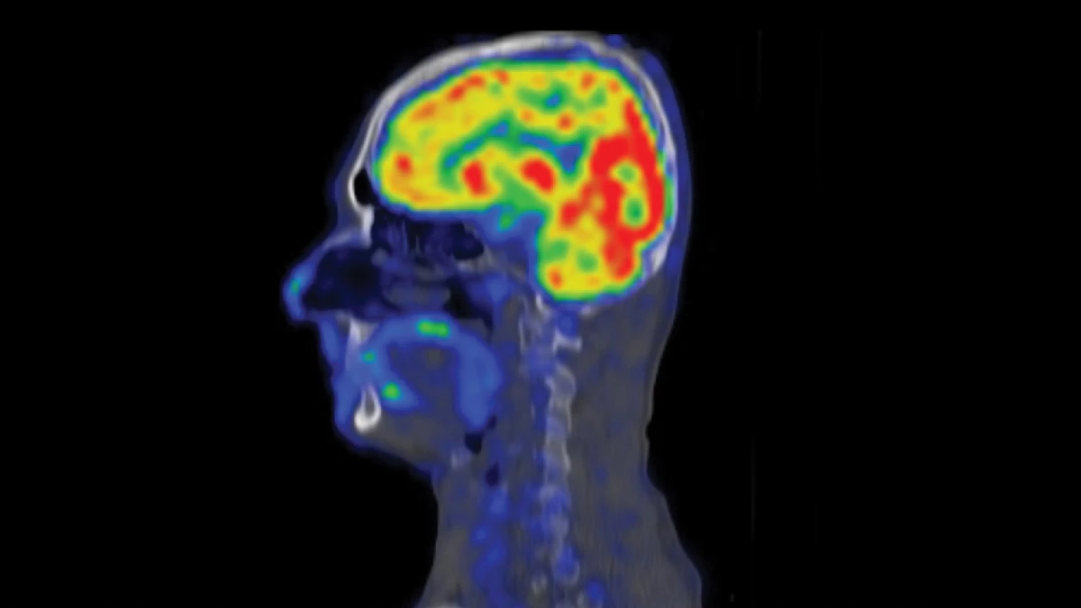 Scientists uncover weakness in brain cancer’s armor