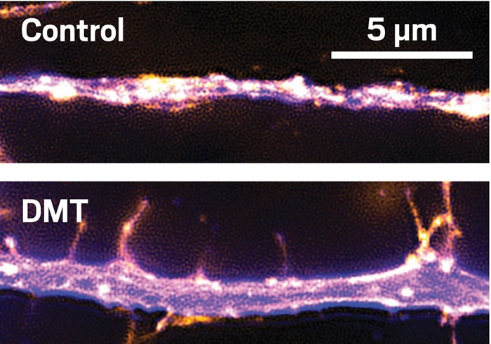 Neurons And Drugs Alcohol And Drugs Rewire Your Brain By Changing How