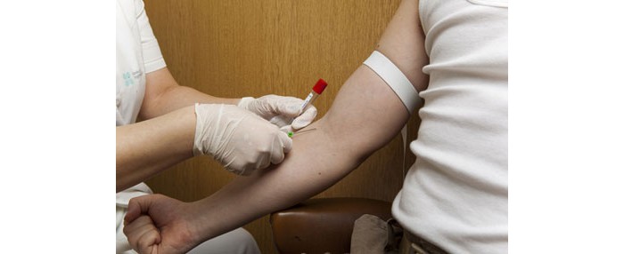 New-Blood-Clotting-Test