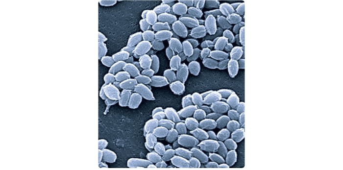 Spotting-Deadly-Spores