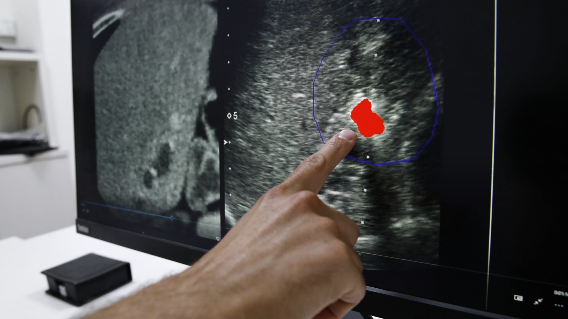 TechsoMed BioTrace Solution | Smart Healthcare powered by Lenovo