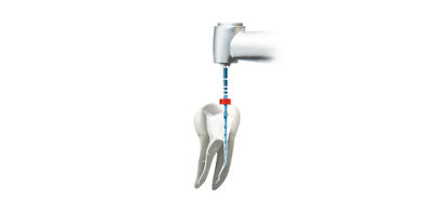 EDDY | Sonic-Powered Irrigation | Dentsply Sirona HR