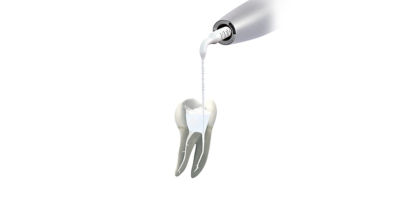EDDY | Sonic-Powered Irrigation | Dentsply Sirona Global