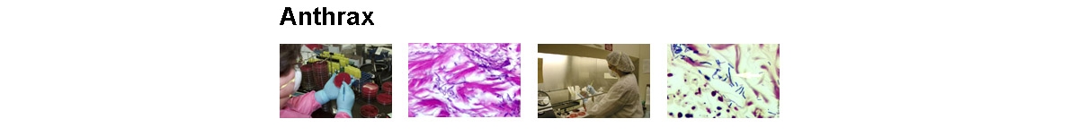 Anthrax Disease Brochure Anthrax | Agriculture And Food