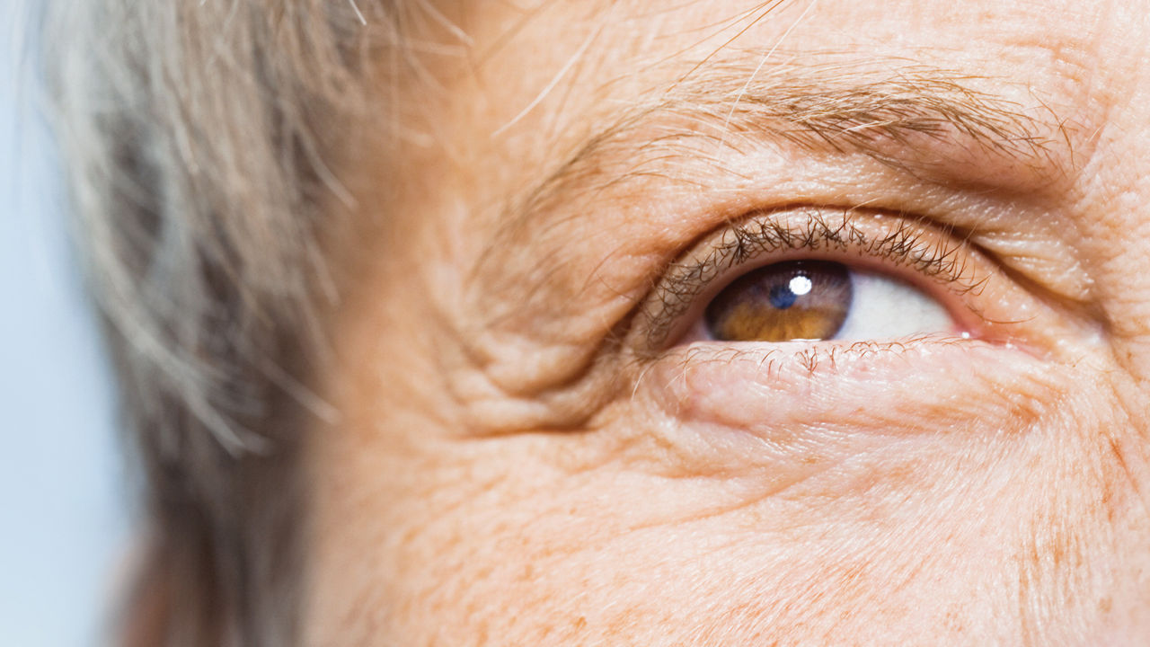 Ocular Surface | Dry Eye Disease | QuidelOrtho